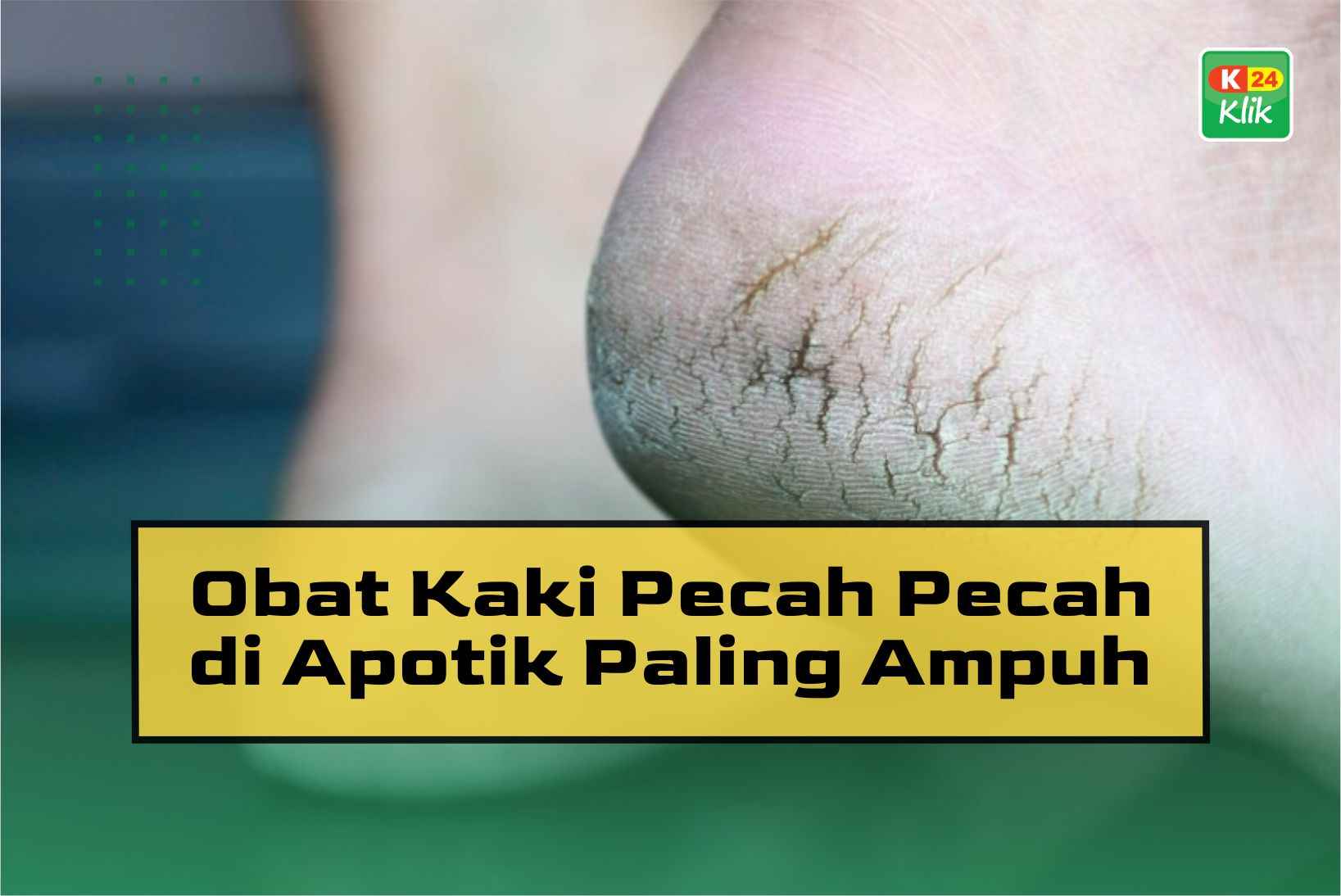 10 Obat Kaki Pecah Pecah di Apotik Paling Ampuh - K24Klik